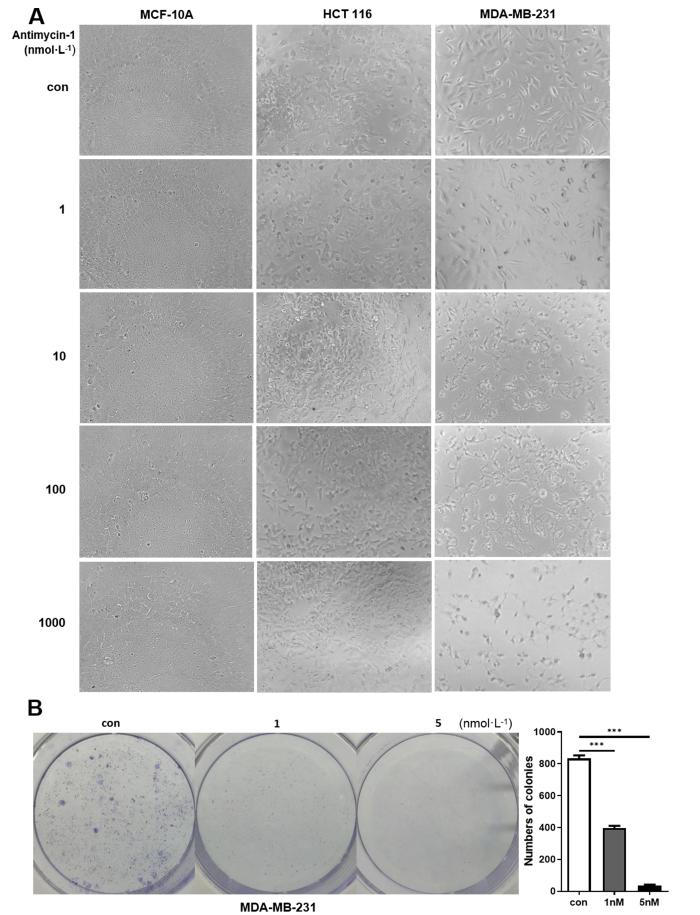 Antimycin类天然产物抗三阴性乳腺癌细胞MDA⁃MB⁃231作用机制初步研究